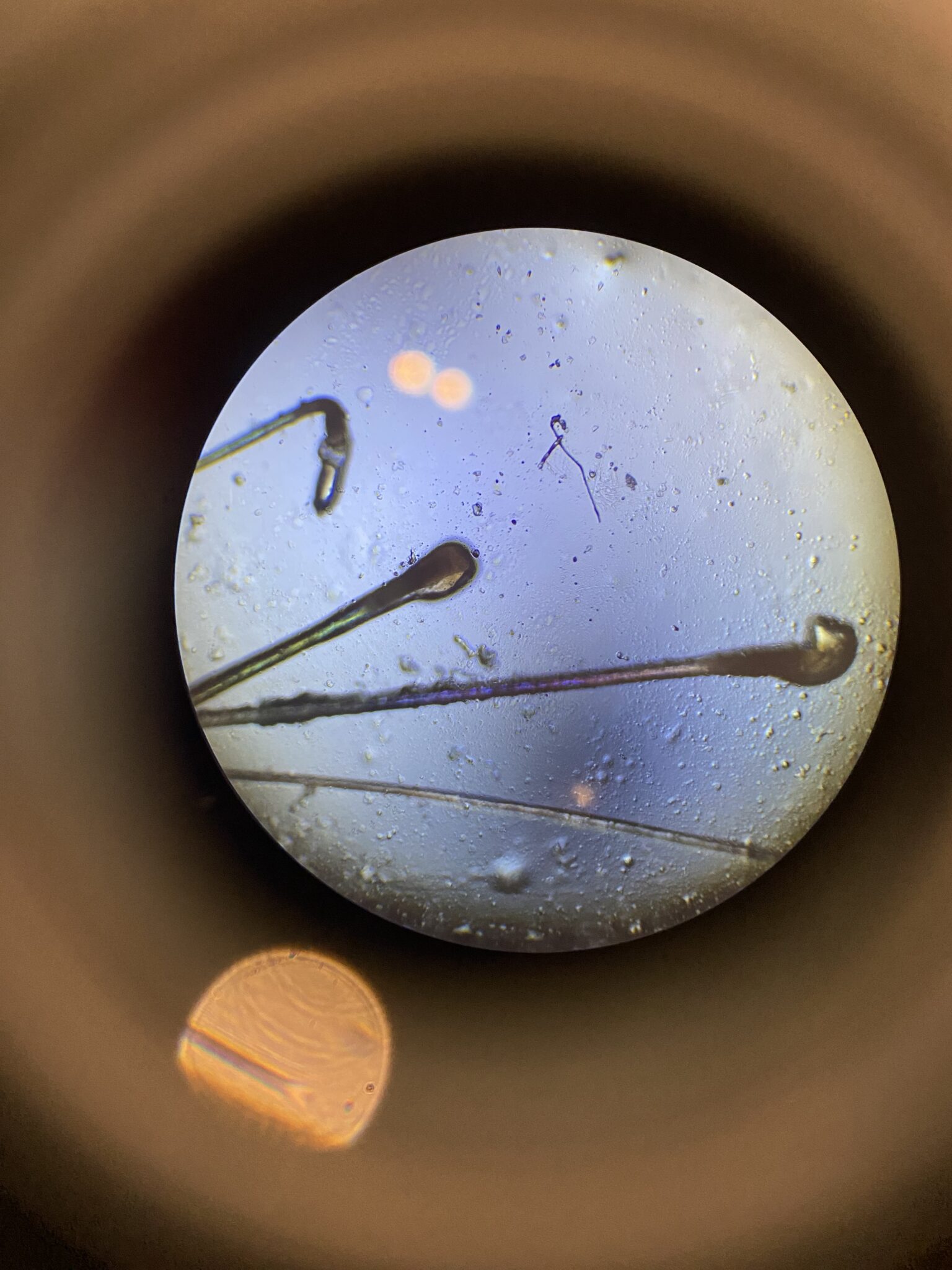 Microscopie capillaire - Le Spa du Cheveu